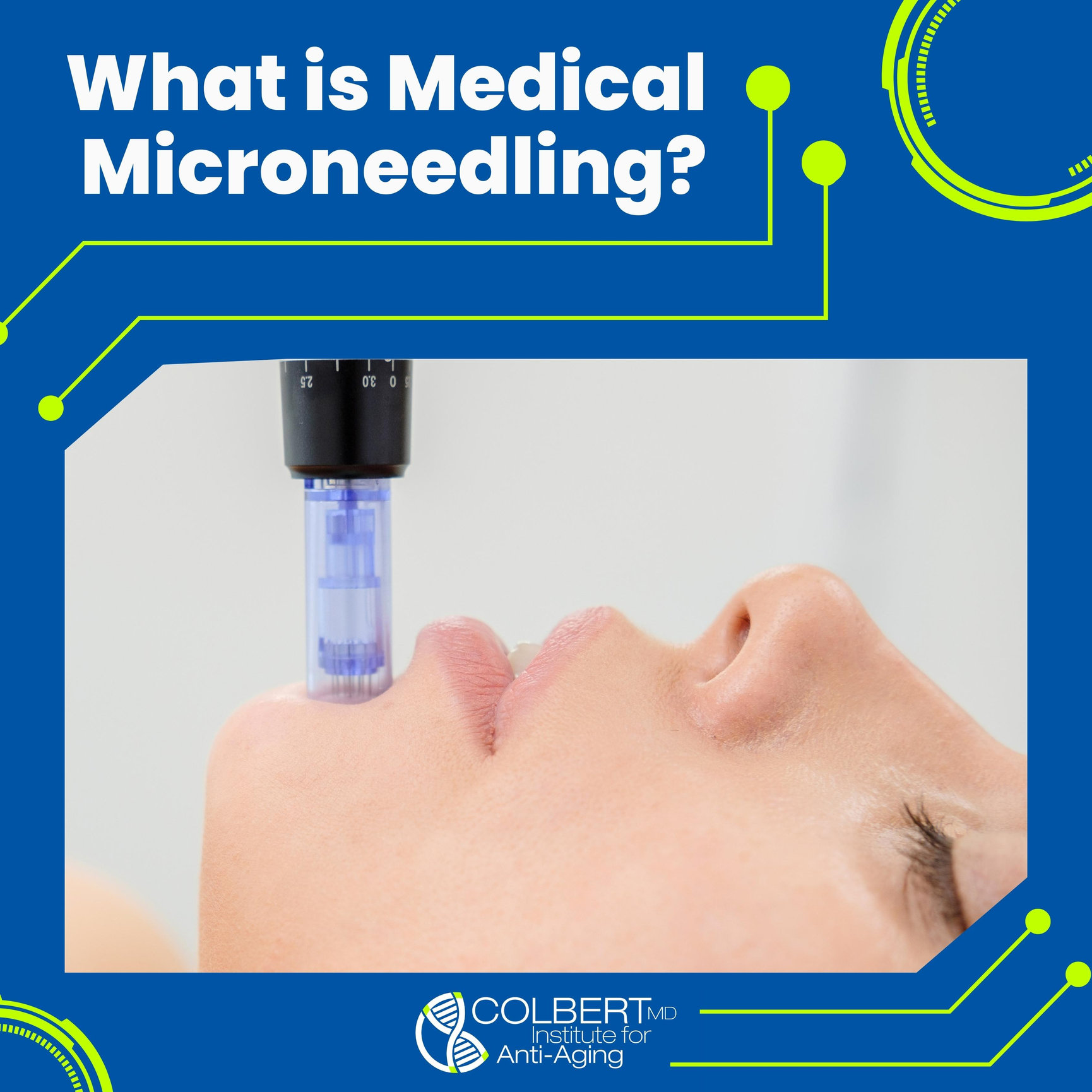 What Is Medical Microneedling Colbert Institute Of Anti Aging What Is Medical Microneedling Colbert Institute Of Anti Aging
