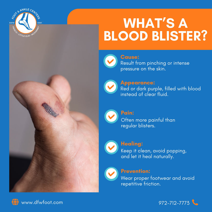 Flat blood blister store
