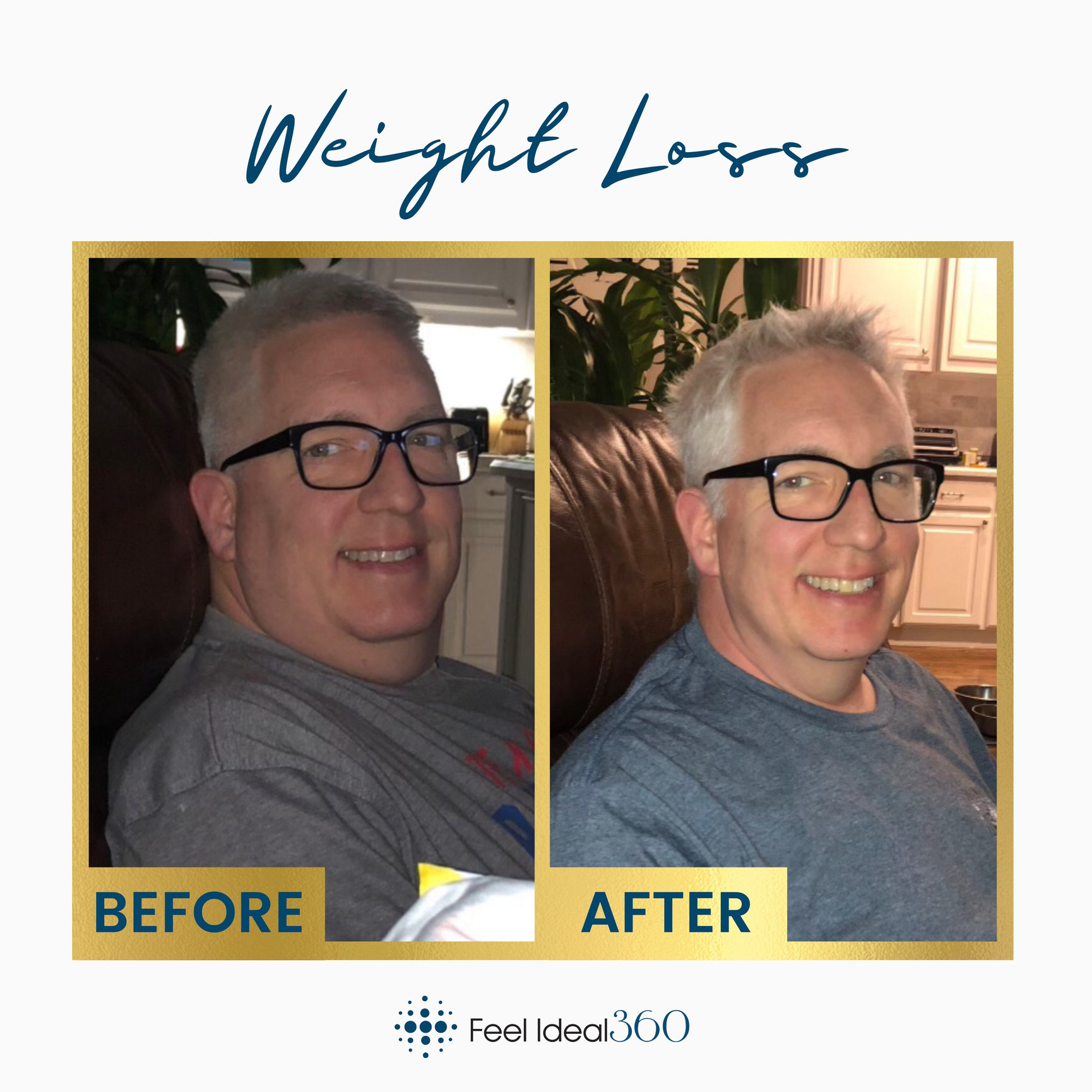 Before And After Weight Loss Feel Ideal 360 In Southlake Tx Feel Ideal